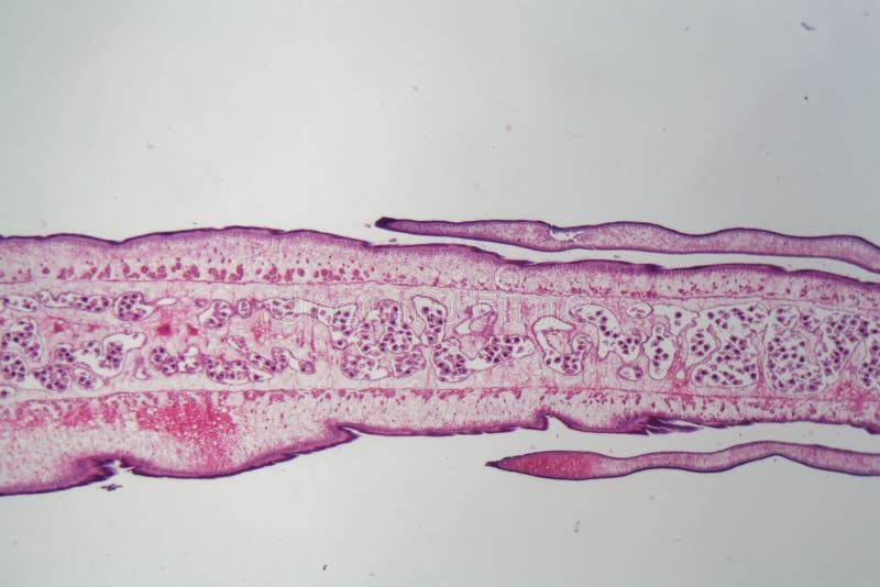 Tapeworm Under A Microscope