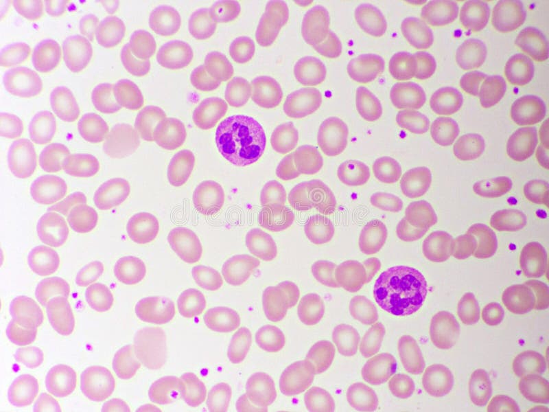 Segmented Neutrophil Cell in Human Blood Smear Stock Image - Image of ...