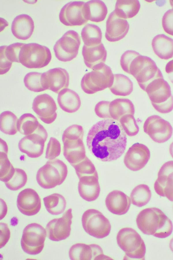 Segmented Neutrophil Cell in Human Blood Smear Stock Image - Image of ...