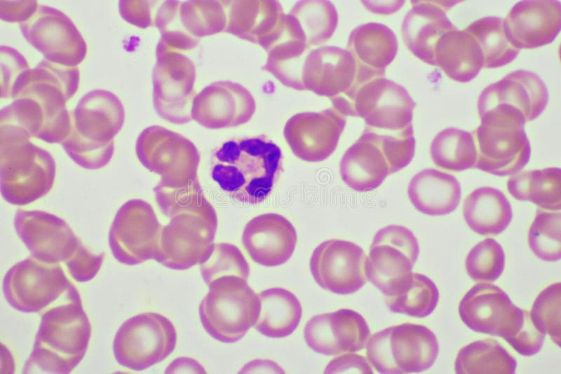 Segmented Neutrophil Cell in Human Blood Smear Stock Photo - Image of ...