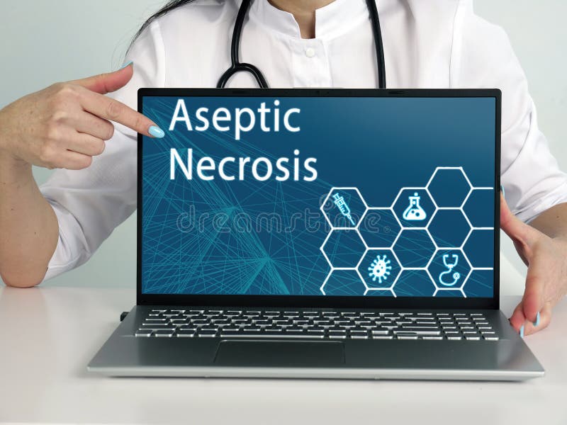 Select Aseptic Necrosis Menu Item. Modern Podiatrist Use Cell ...