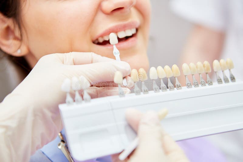 Selection of the Correct Tooth Color during Bleaching Stock Image ...