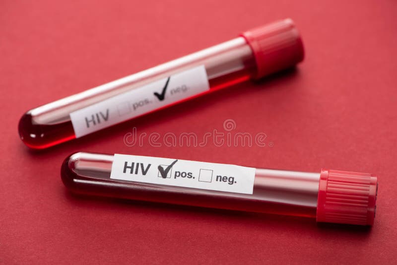 Focus of Negative and Positive Hiv Stock Image - Image of result ...