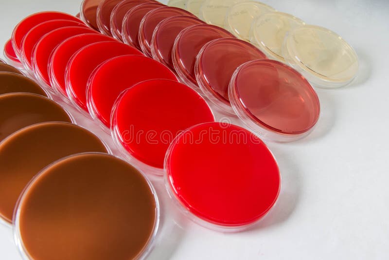 Selective Media for Bacteria Growth. Stock Photo - Image of healthcare ...