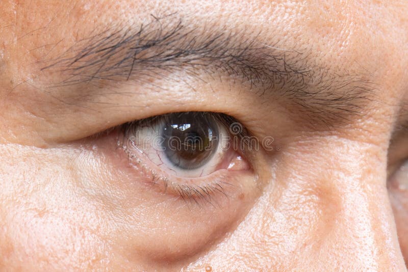 Senior Man Eye Strain after for Long Stretches at Computer. Stock Photo ...