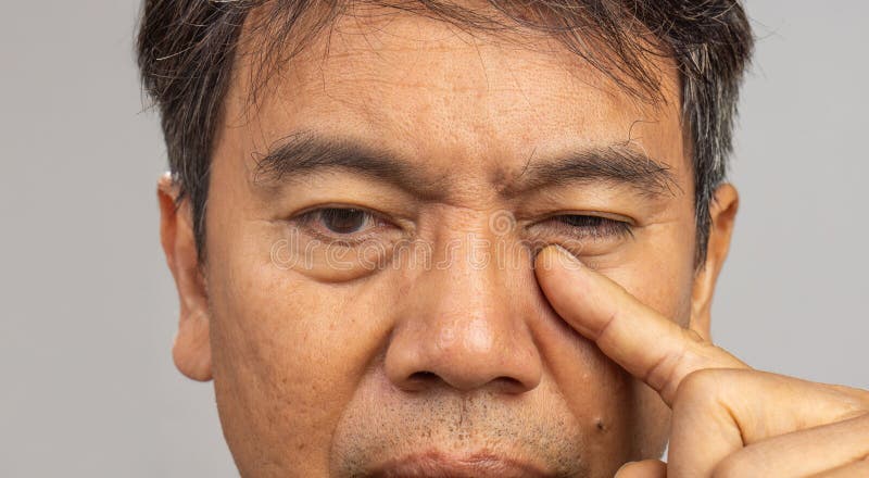 Senior Man Eye Strain Long Stretches Computer Digital Screens Stock ...