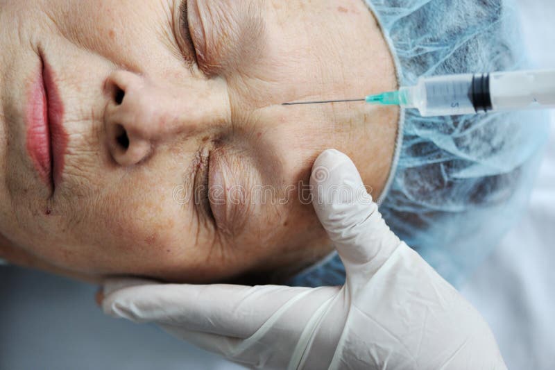 Senior Woman Getting on Face Injection Stock Photo - Image of face ...