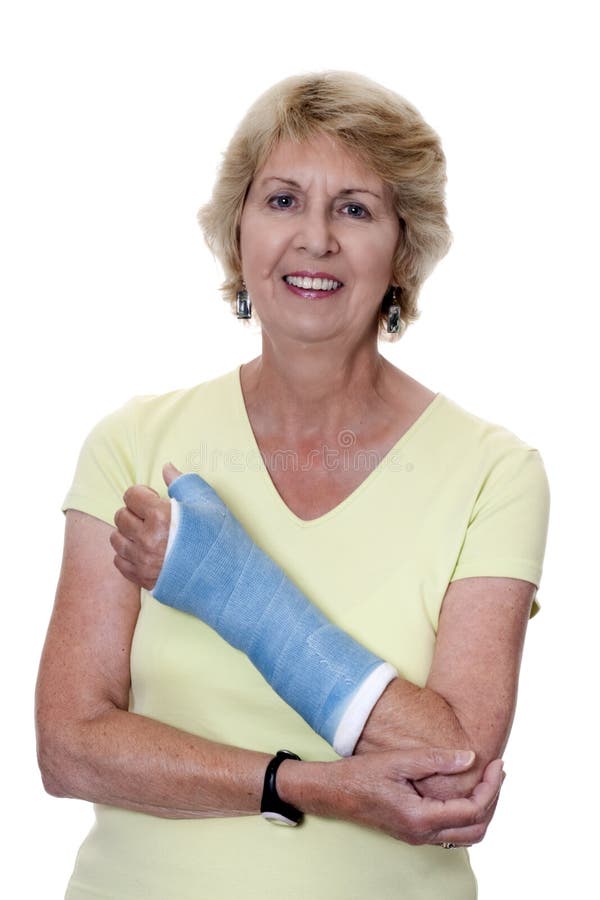 Senior Woman Holding Left Arm in Cast Stock Image - Image of injury ...