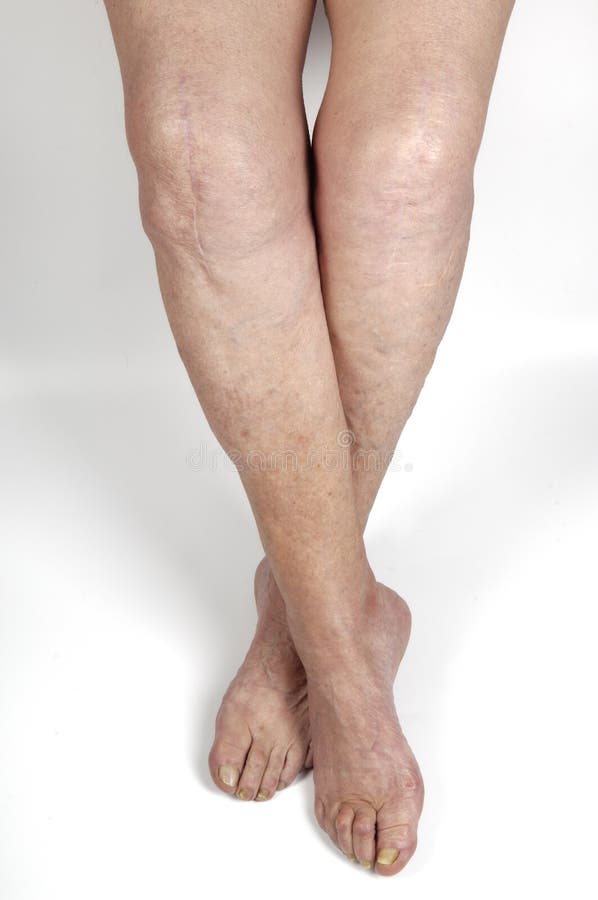 Senor woman leg stock image. Image of studio, females - 63674937