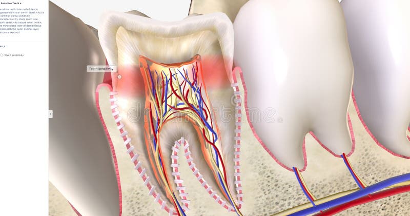 Sensitive Teeth is a Common Dental Condition Characterized by Sharp ...