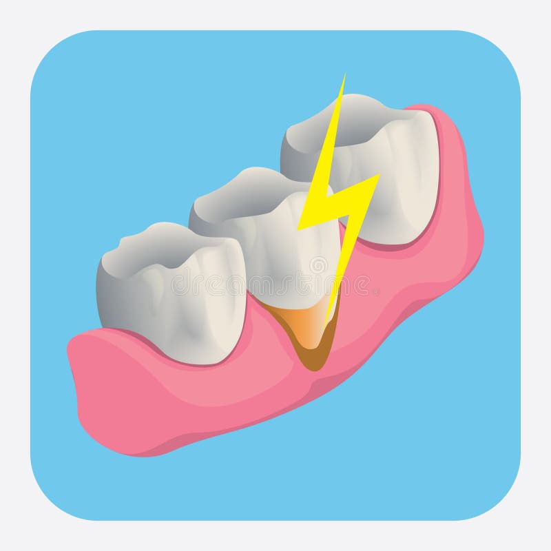 Sensitive Tooth. Vector Illustration Decorative Design Stock Vector ...