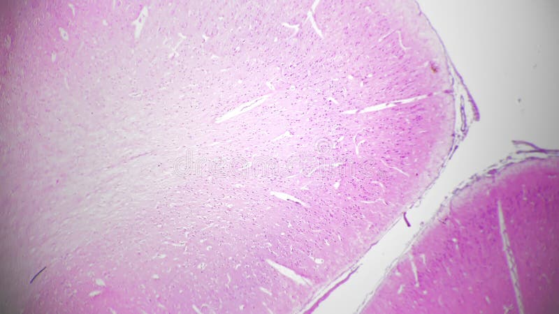 Sensory Cortex in Section of Human Magnified in 400 Times Under ...