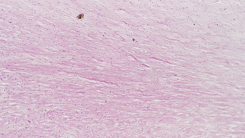 Sensory Cortex in Section of Human Magnified in 40 Times Under ...