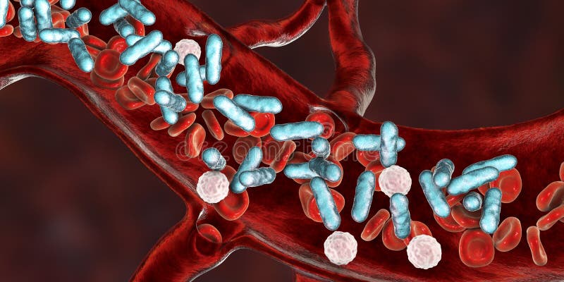 Septicité, Bactéries Dans Le Sang Illustration Stock - Illustration du ...