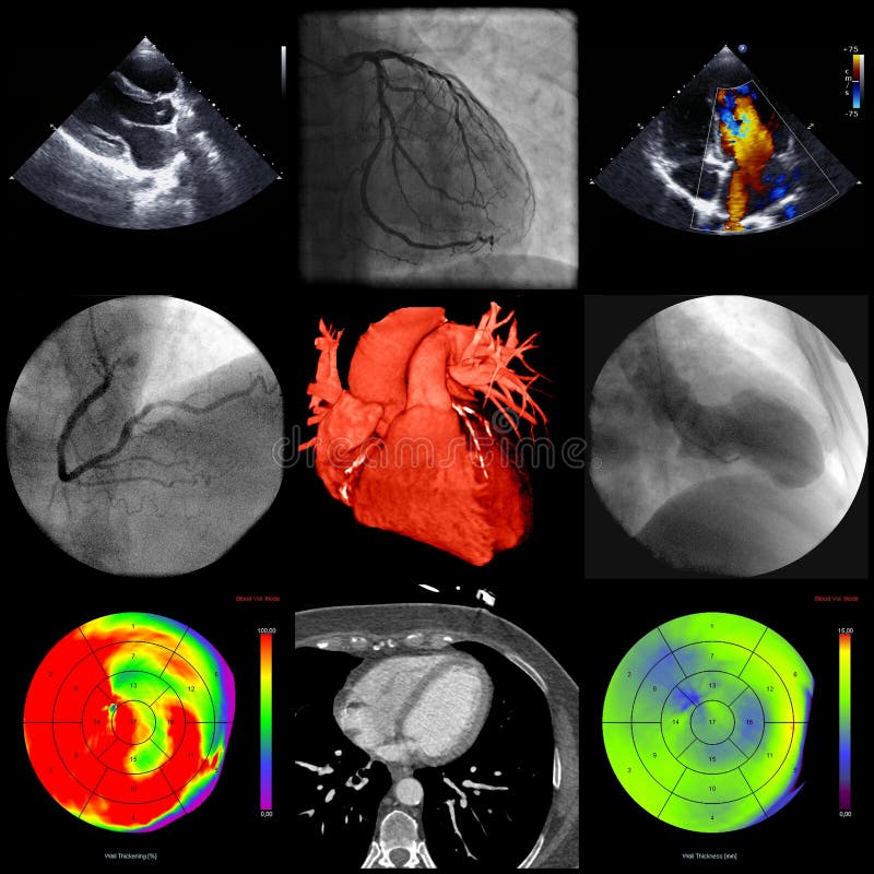 A Series of Cardiac Imaging with Different Techniques Stock Image ...