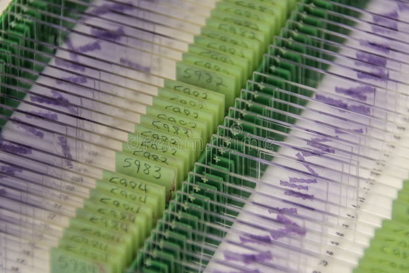 Series of Histology Specimen Slides Stock Photo - Image of chemistry ...