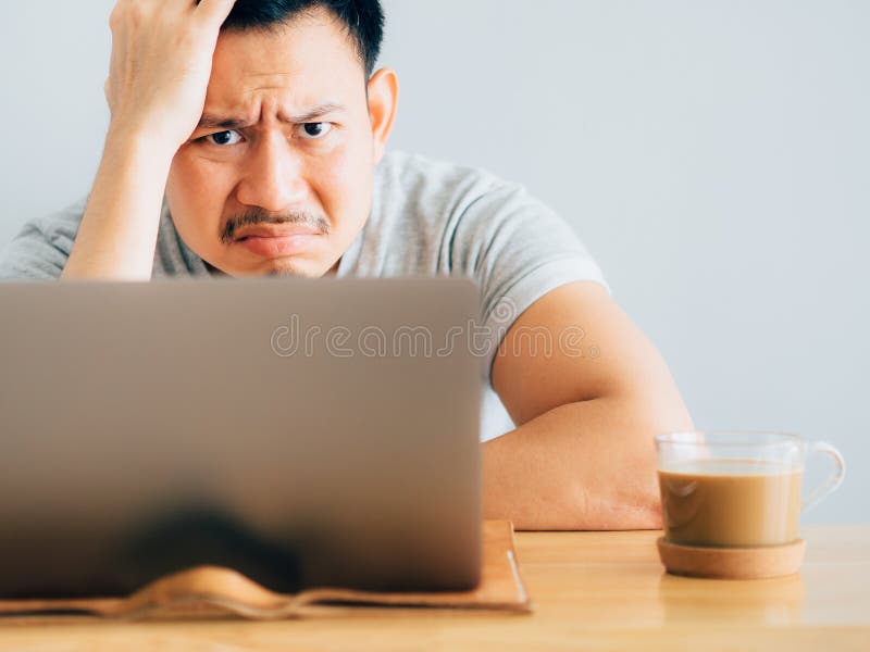 Boring and Serious Face Man Rest His Chin on His Hand. Stock Image ...