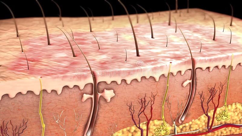 Serious Burns on Human Skin Stock Illustration - Illustration of ...
