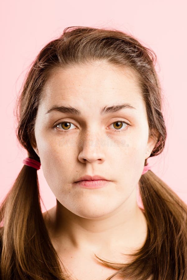 Closeup Portrait of Caucasian Woman with Freckles and Cleft Lip Looking ...