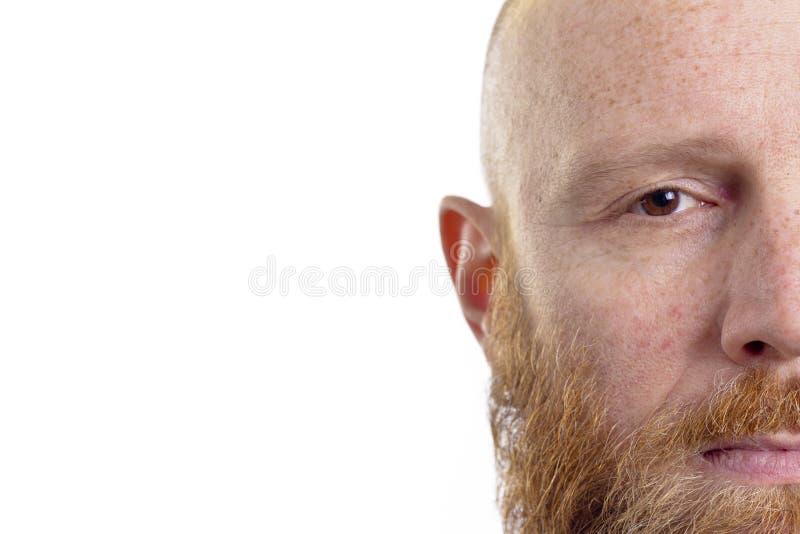 Silly Bald Man with Red Beard and Crossed Eyes Stock Photo - Image of ... Silly Bald Man with Red Beard and Crossed Eyes Stock Photo - Image of ...