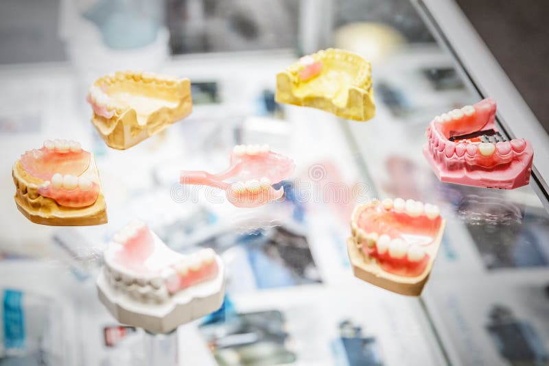 361 Denture Samples Stock Photos - Free & Royalty-Free Stock Photos ...