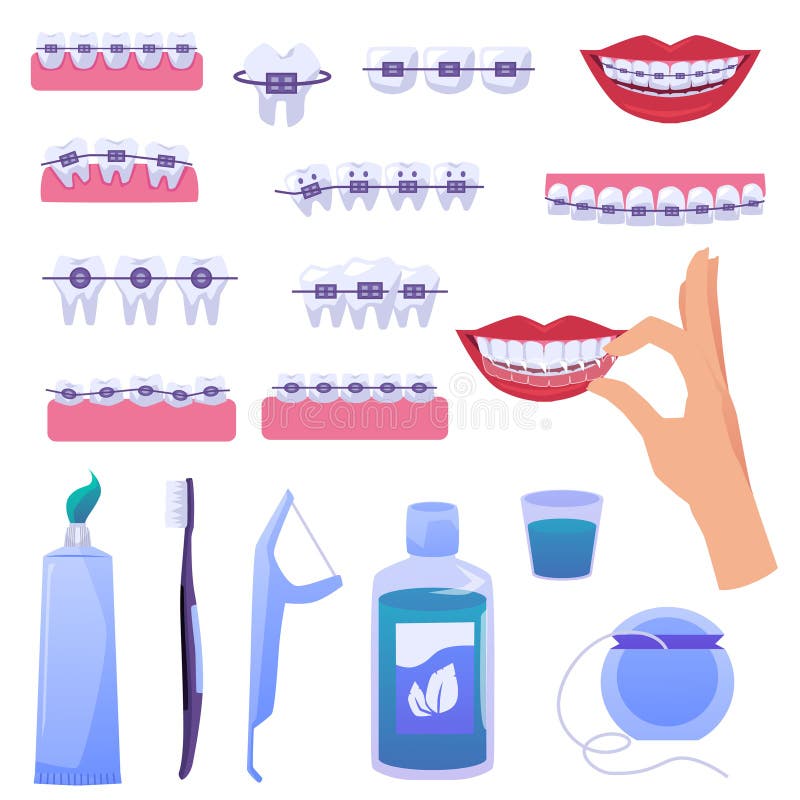 Set of Design Elements about Teeth Braces Flat Style, Vector ...