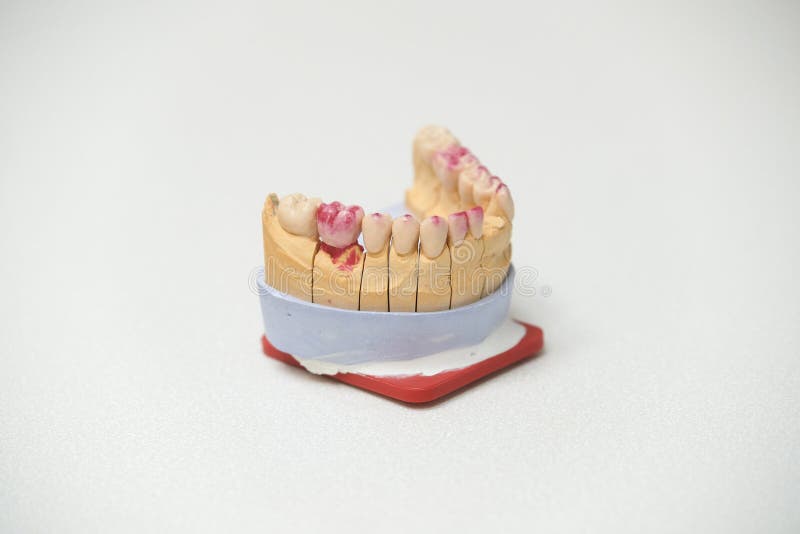 Set of the false teeth stock photo. Image of cabinet - 129711964