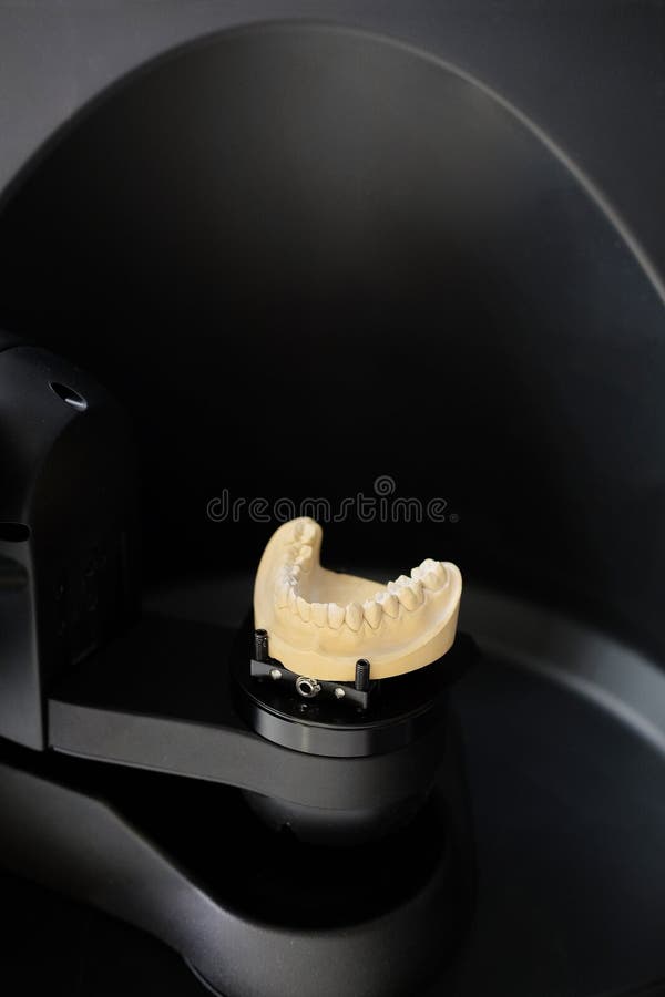 Set of False Teeth Processed in the Special Device for Dentists Stock ...