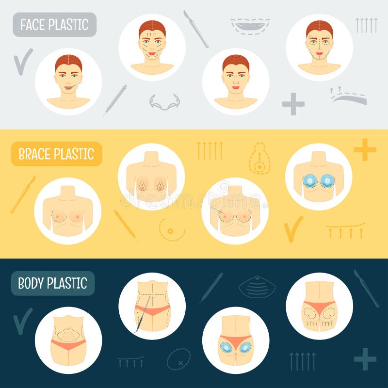 Set of Horizontal Banners. Plastic Surgery Concept. Flat Design Stock ...