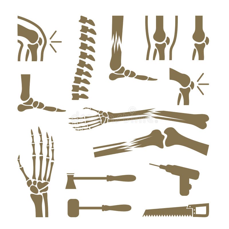 Set of Human Bone Orthopedic Logo Concept Vector. Bone X-ray Image of ...