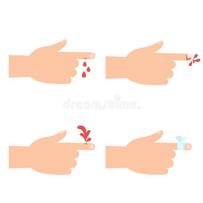 Set of injure hand stock vector. Illustration of injured - 368216757
