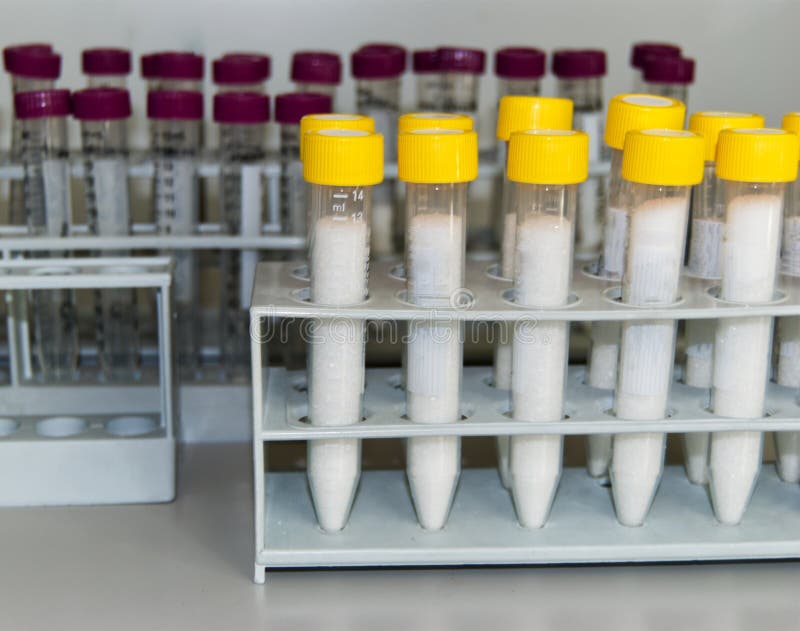 Set of Laboratory Test Tube with Yellow Cap on Display Stock Photo ...