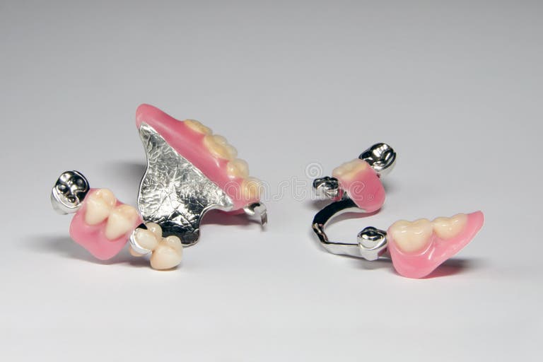 848 Removable Dental Bridge Stock Photos - Free & Royalty-Free Stock ...