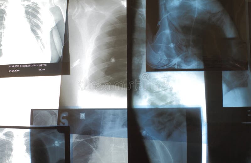 Set of Radiographs on X-ray View Box Stock Image - Image of ...