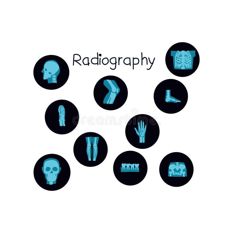 Set of Radiography Design Vector Illustration Stock Vector ...