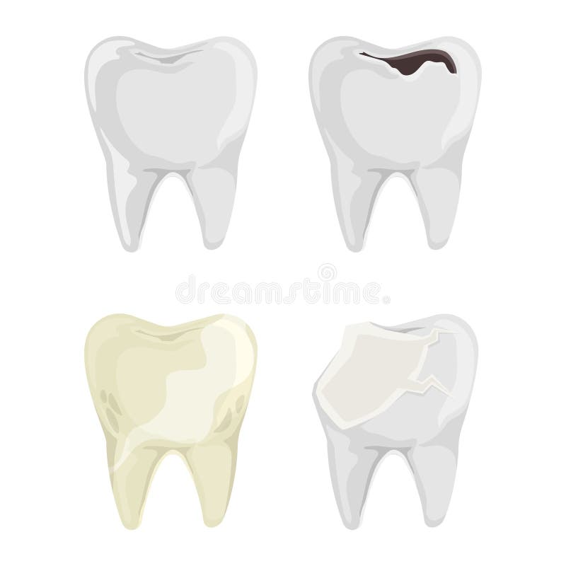 Set of Teeth. Dental Problems. Broken Tooth, Yellow Tooth, Tooth with ...