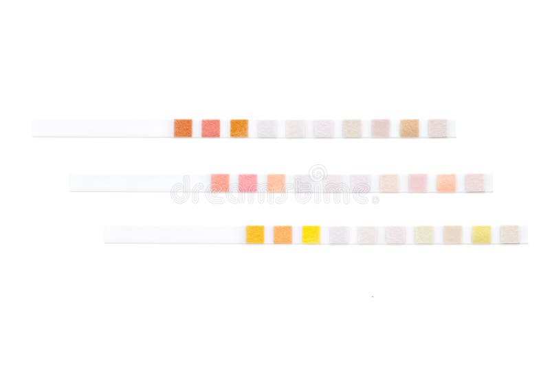 Strips Lab Testing Water Stock Photos - Free & Royalty-Free Stock ...