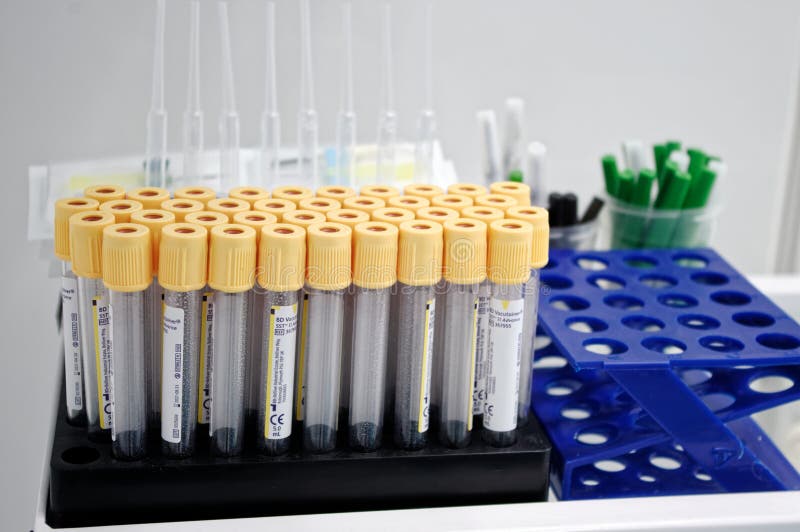 Tubes for blood samples stock photo. Image of diagnostics - 372159386