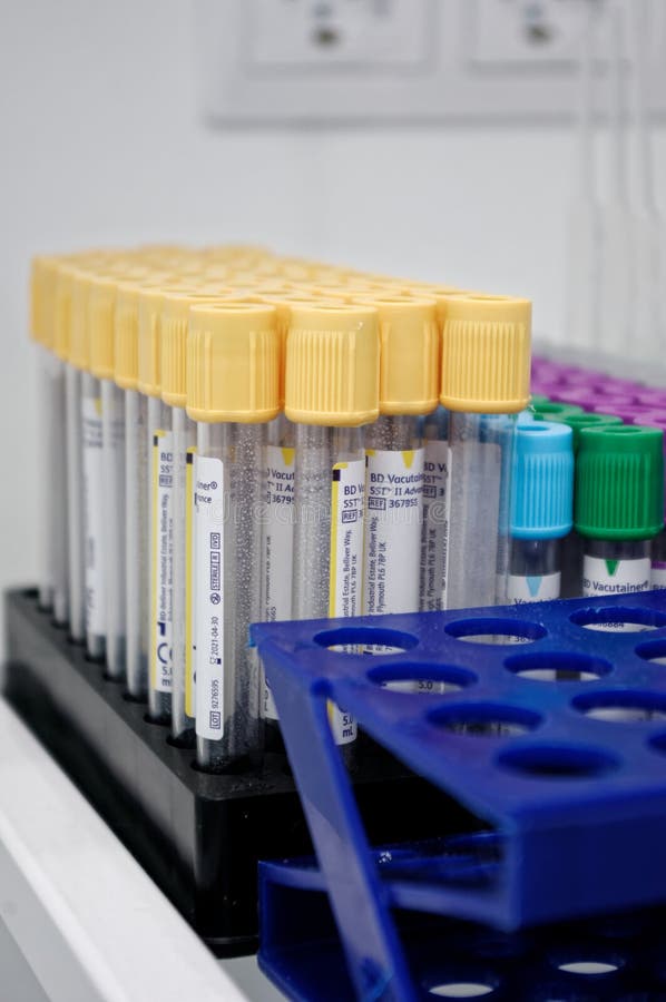 Tubes for blood samples stock image. Image of laboratory - 372159421