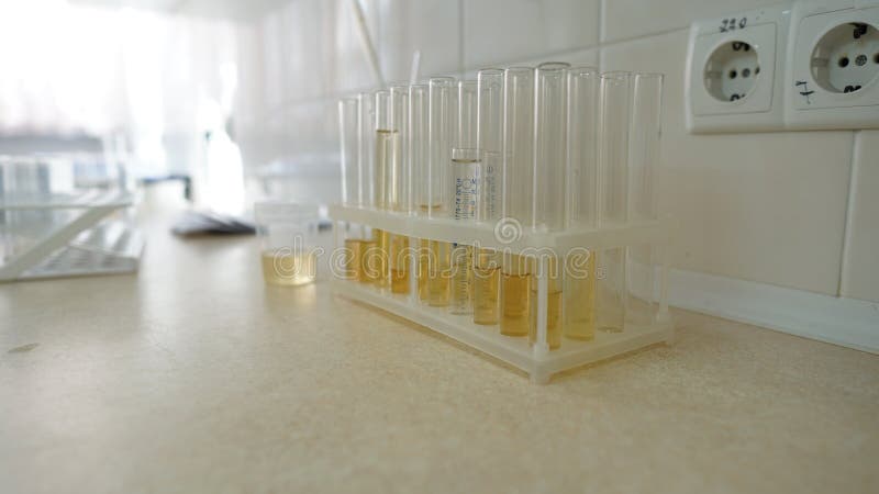 Set of Test Tubes Close-up in Laboratory in Plastic Box Holder Stock ...