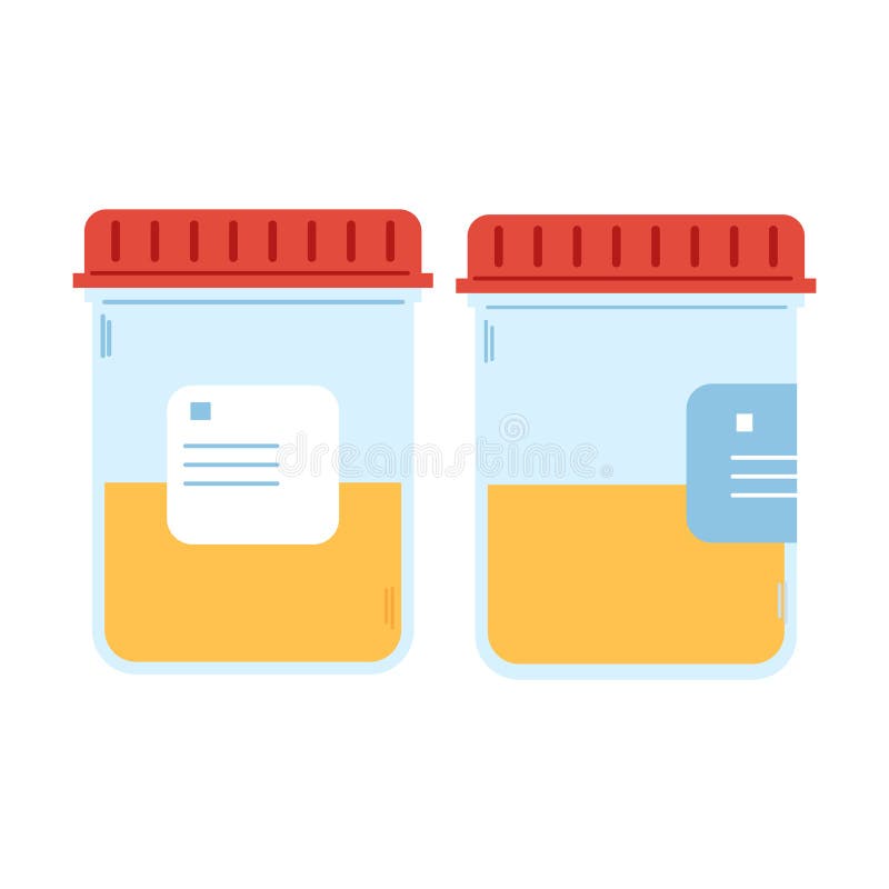 Set of Two Medical Tubes with Urine Samples. Laboratory Container Stock ...