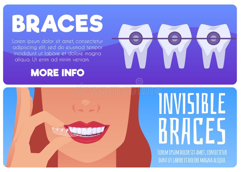 Set of Website Banner Templates about Braces Flat Style Stock Vector ...