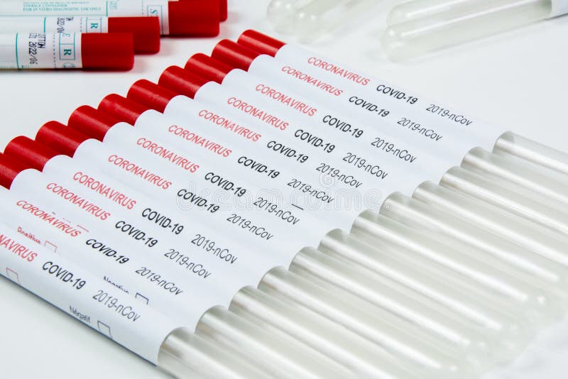 Covid-19. Swabs for PCR Tests Stock Photo - Image of saliva, covid ...