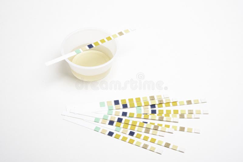 Urine Reagent Test Strips and Specimen Stock Photo - Image of measure ...