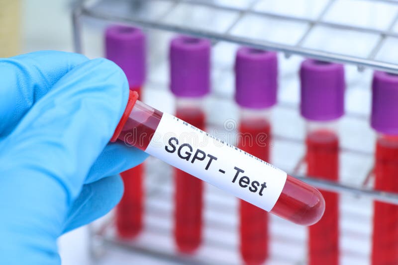 SGPT Test To Look for Abnormalities from Blood Stock Image - Image of ...
