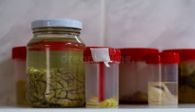 On the Shelf are Jars Filled with Formaldehyde with Internal Organs ...