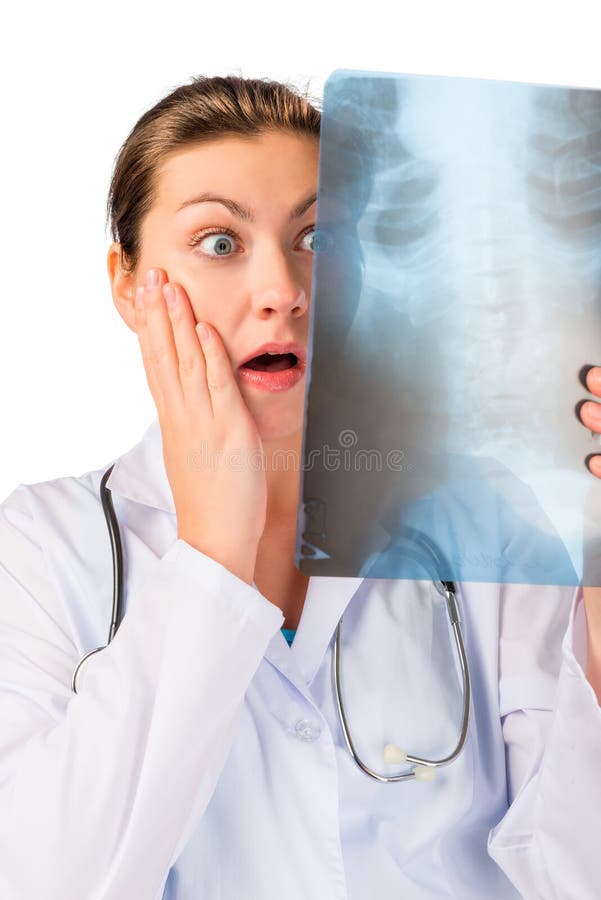 Shocked doctor with x-ray stock photo. Image of adult - 51230030