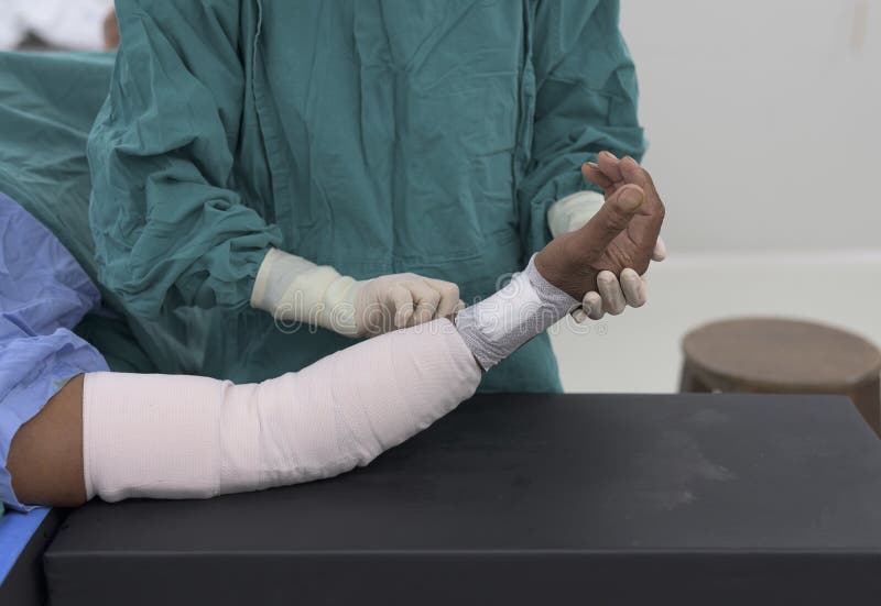 Short arm slab stock image. Image of hand, medical, insurance - 56167797