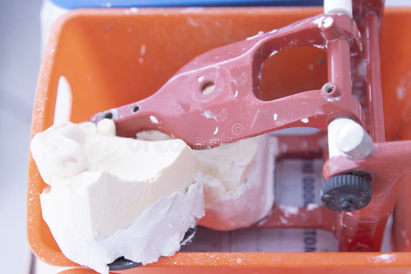 Shot of Dental Impression Molds for Reconstruction Stock Photo - Image ...
