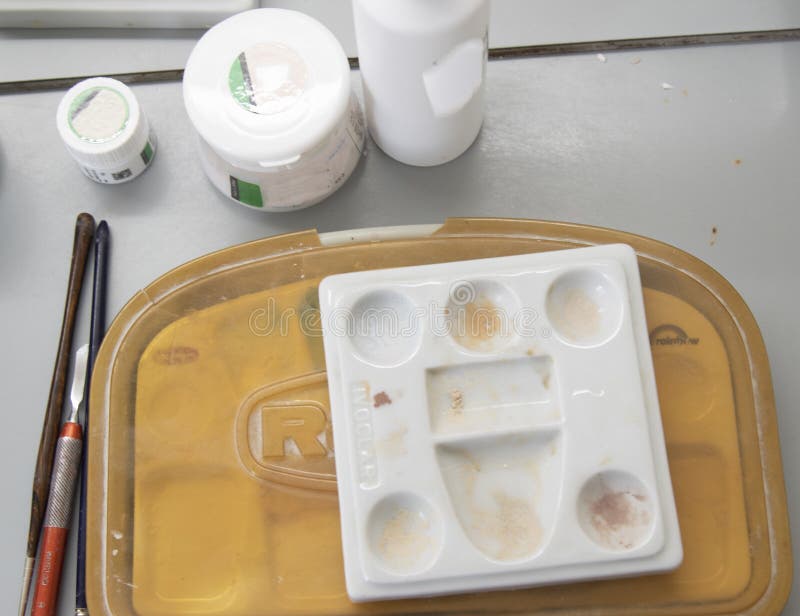 Shot of Dental Impression Molds for Reconstruction Stock Photo - Image ...